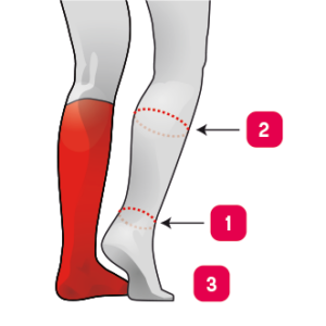 Om kompression - Mabs